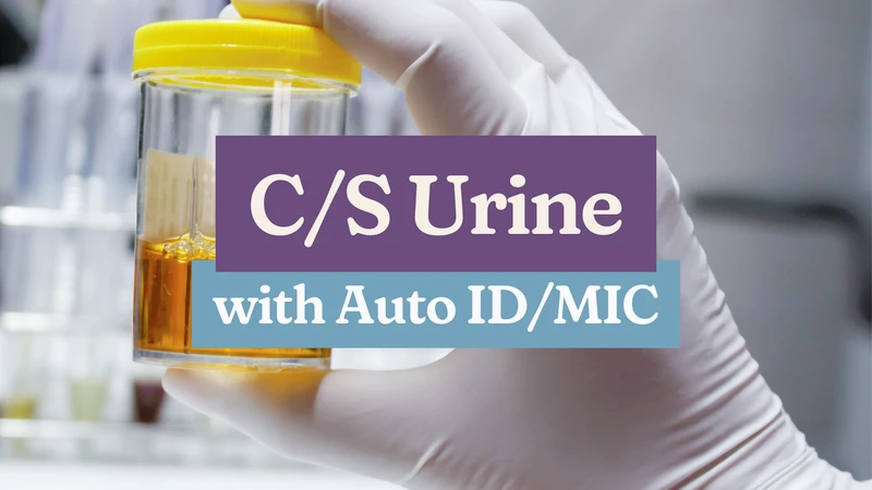 C/S Urine w/ Auto ID/MIC by Hi-Precision at MALOLOS BULACAN