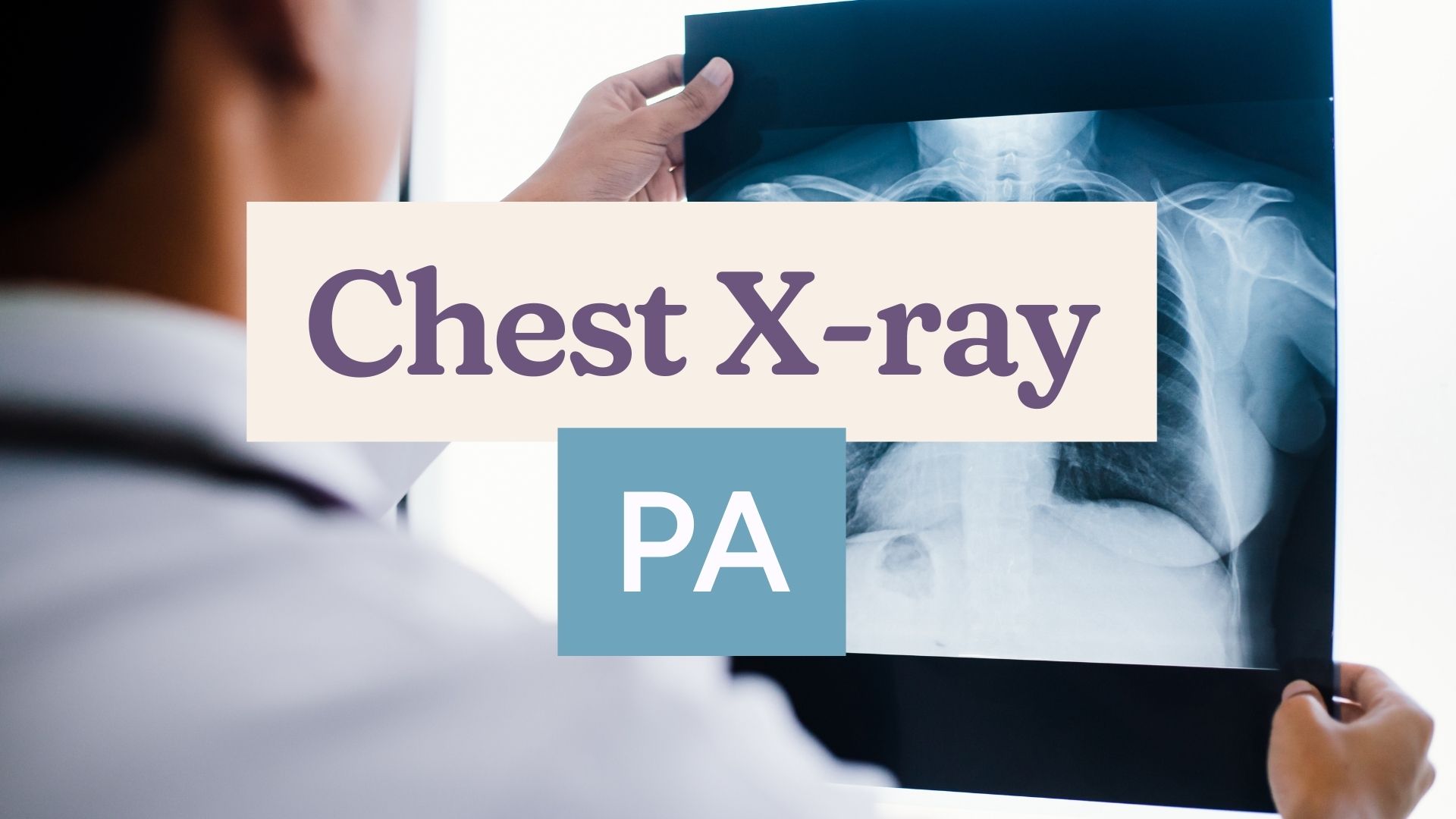 Chest X-ray PA by Hi-Precision at ANGELES PAMPANGA