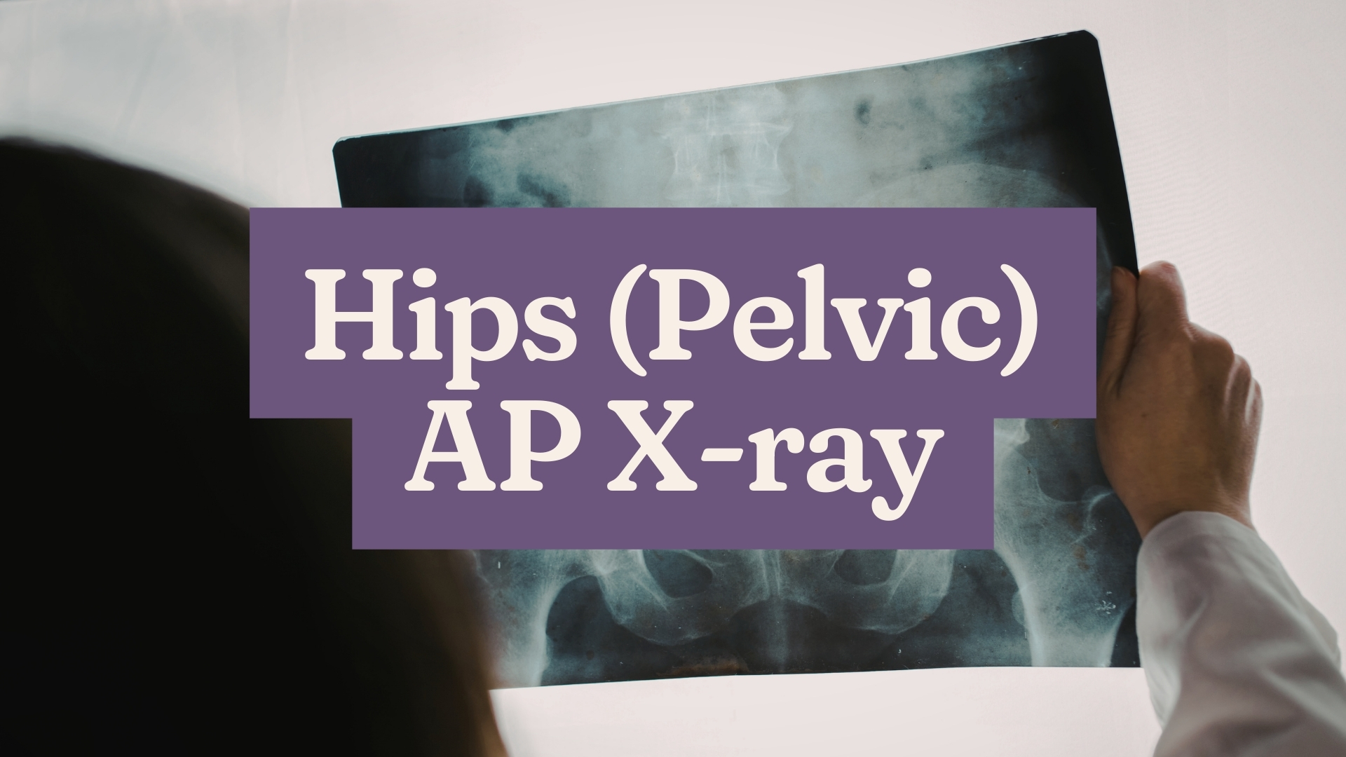 Hips (Pelvic) AP X-ray by Hi-Precision Plus at KATIPUNAN