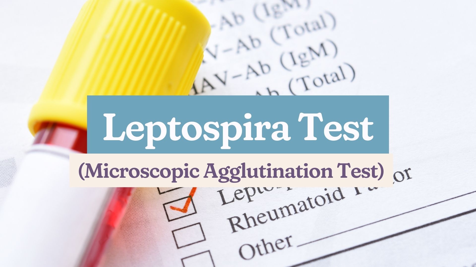 Leptospira Test (Microscopic Agglutination Test) by Exact Check at ...