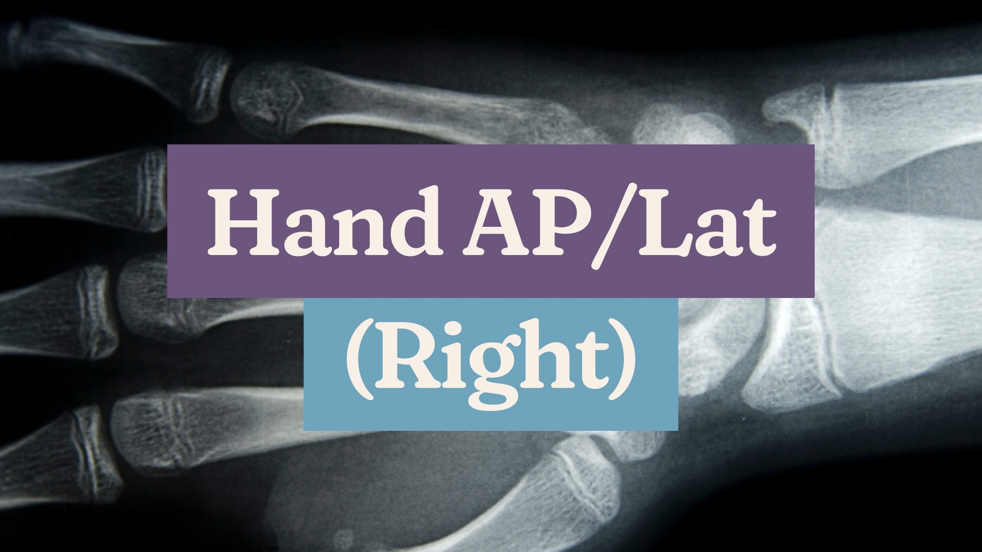 Hand AP/LAT (R) X-ray | Hati Health