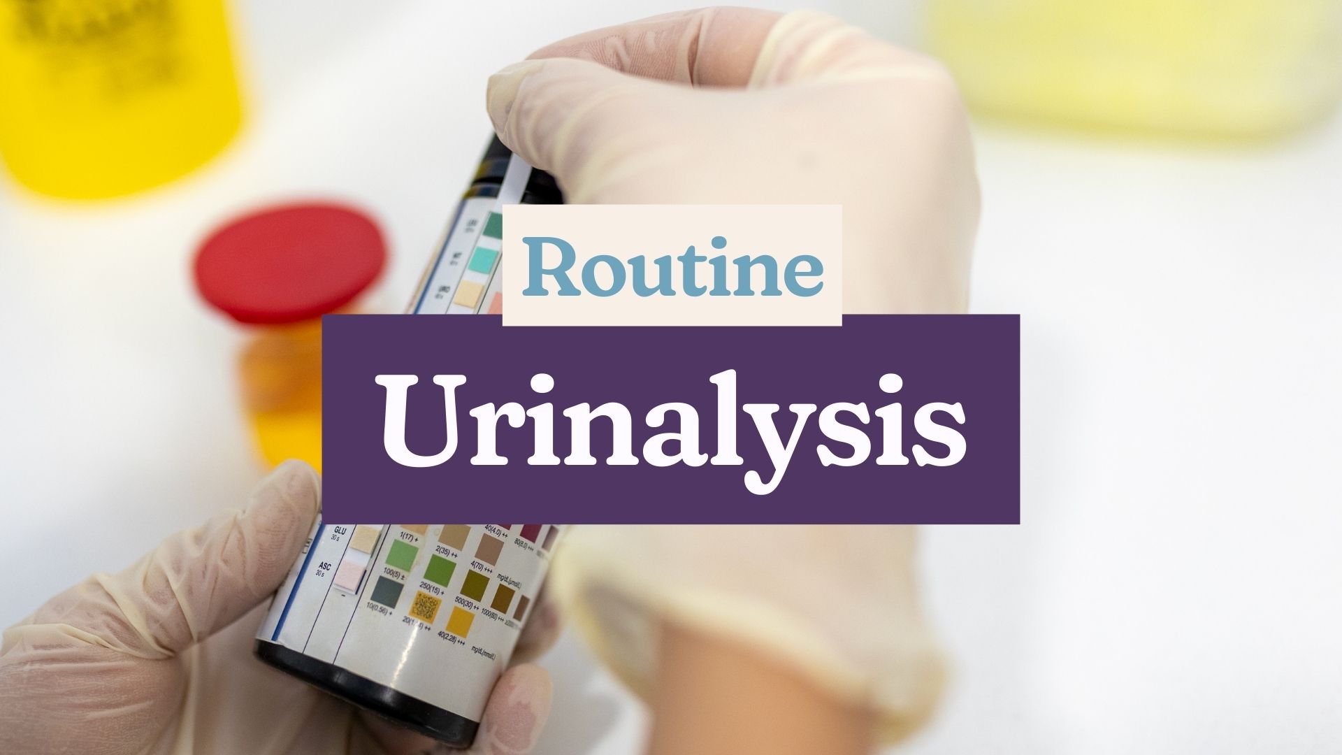 Routine Urinalysis by CHECKPOINT LABS at CHECKPOINT ALABANG