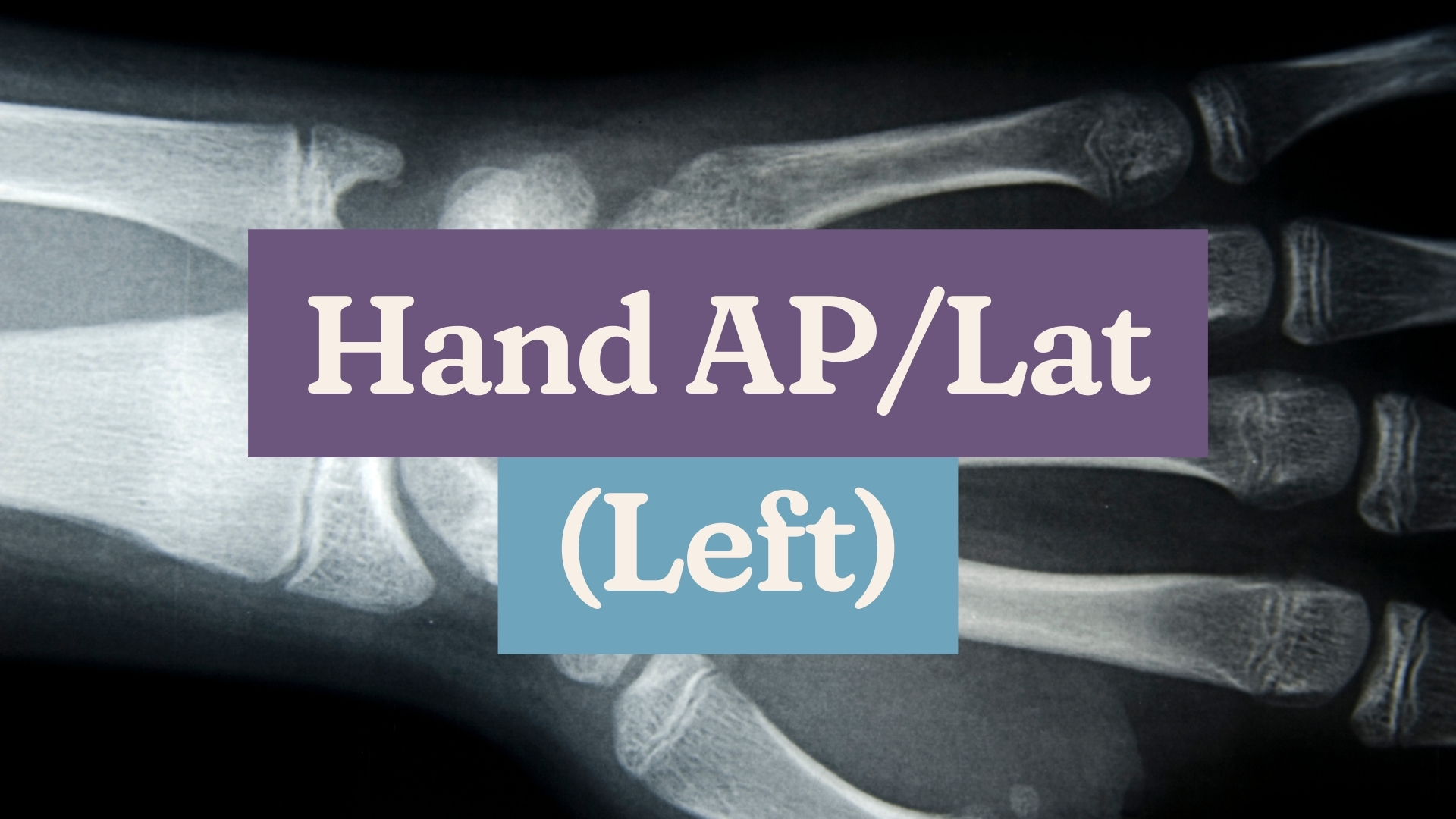 Hand AP/LAT (L) X-ray by Hi-Precision at PASIG | Hati Health