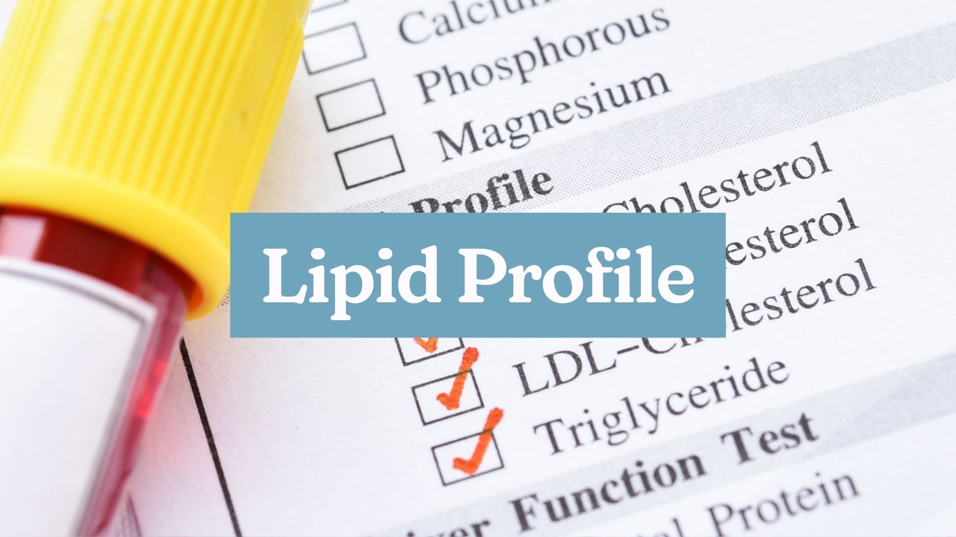 Lipid Profile by Hi-Precision at NOVALICHES | Hati Health