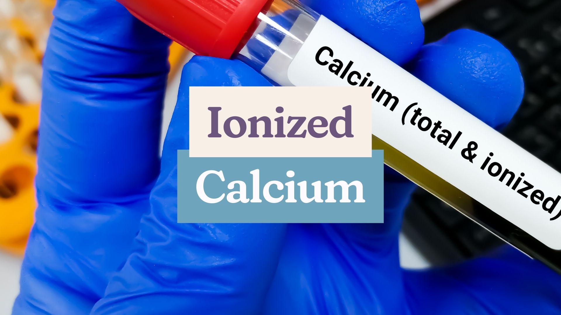 Ionized Calcium by CHECKPOINT LABS at CHECKPOINT ALABANG