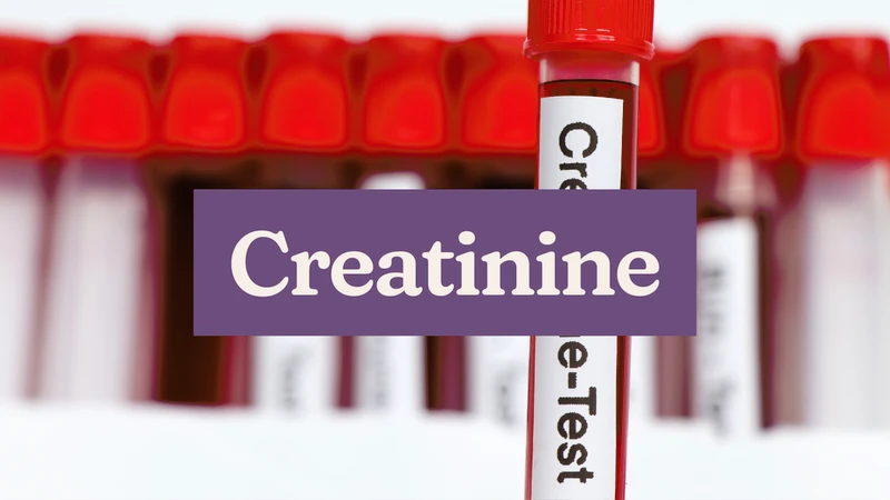 Creatinine by CHECKPOINT LABS at CHECKPOINT LABS - Home Service