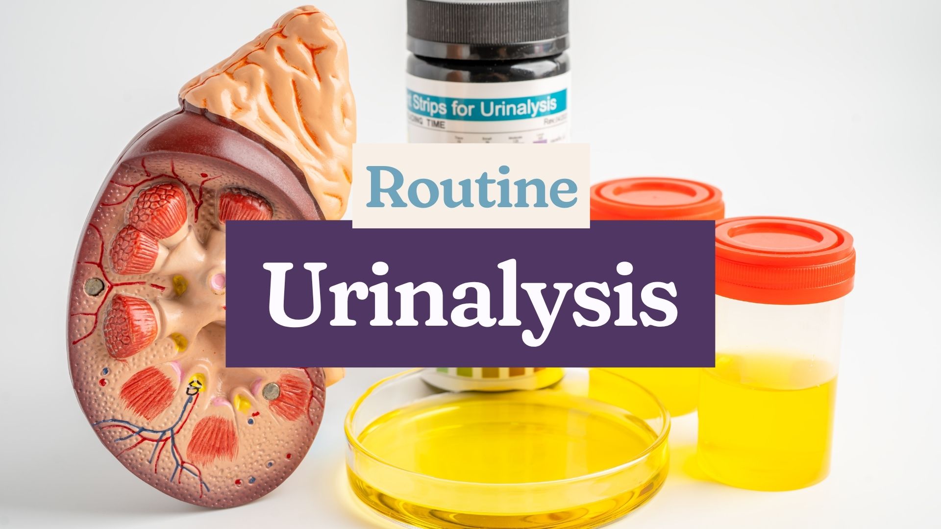 Routine Urinalysis by CHECKPOINT LABS at CHECKPOINT LABS - Home Service